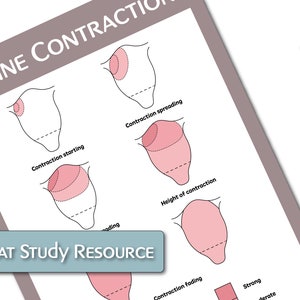 Uterine Contractions Educational Poster - Etsy