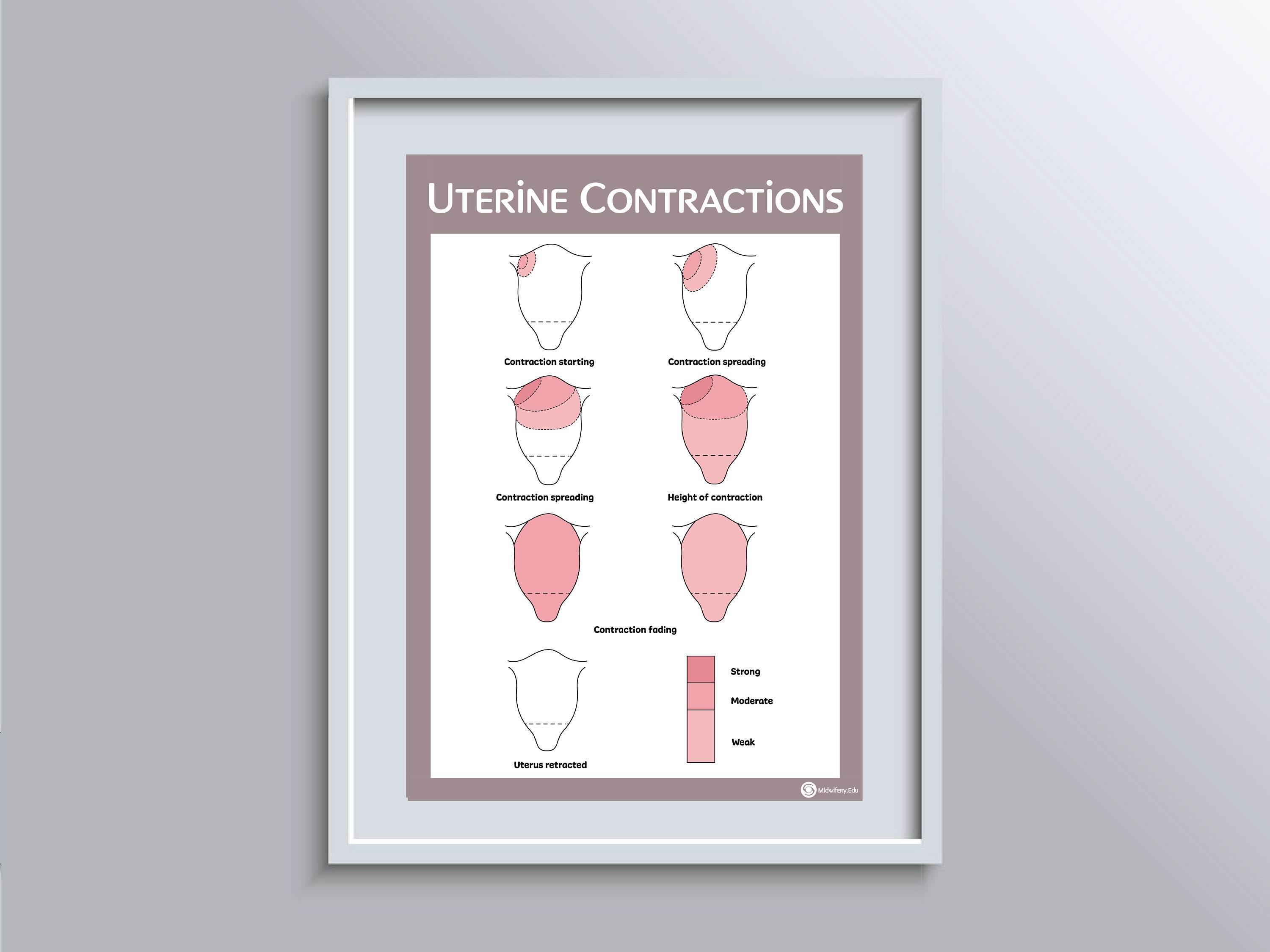 Uterine Contractions Educational Poster - Etsy