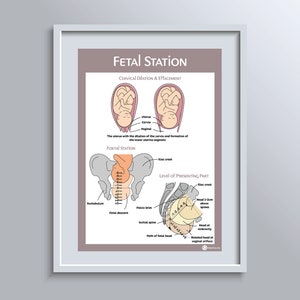 Foetal/fetal Station Educational Poster - Etsy