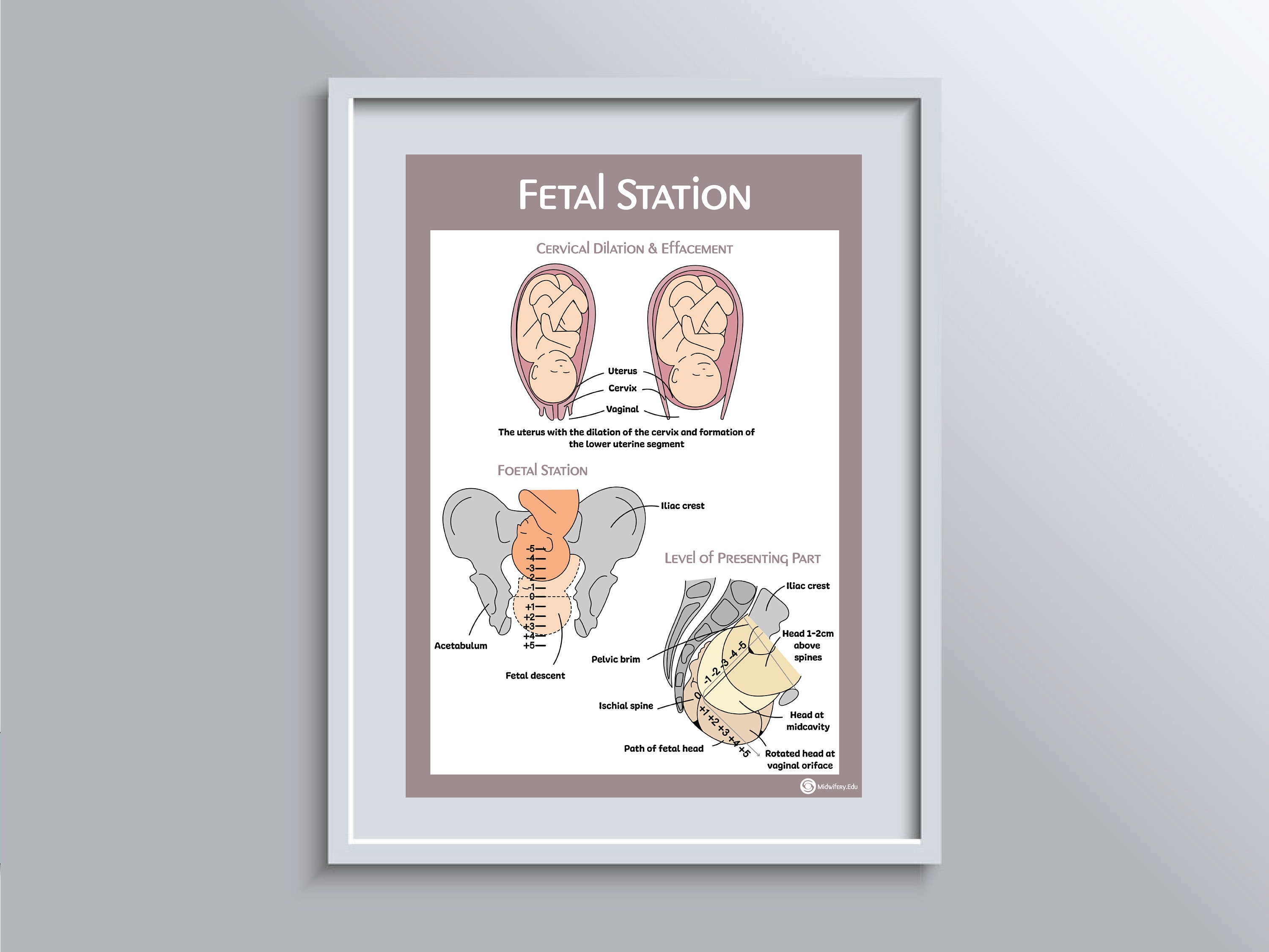 Foetal/fetal Station Educational Poster - Etsy