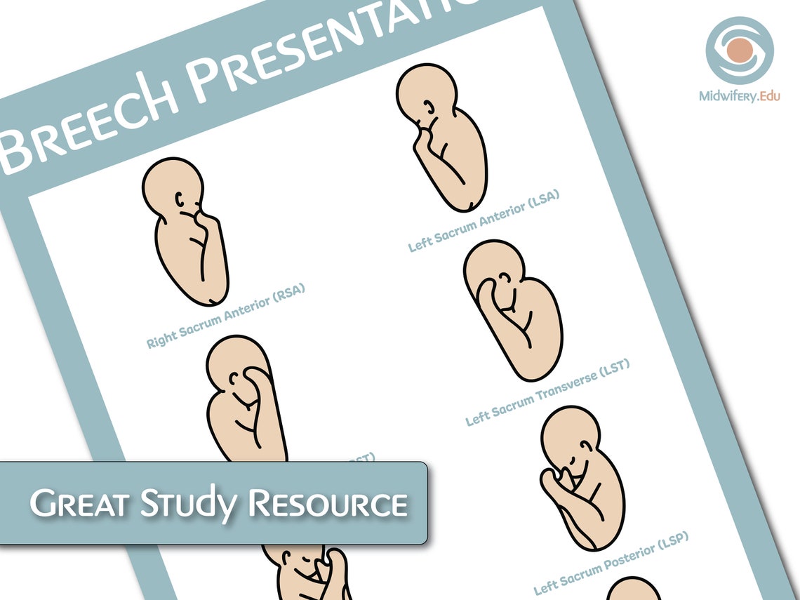 Foetal/fetal Position Study Bundle Educational Poster - Etsy