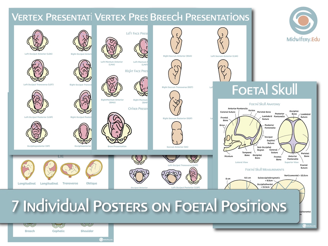 Affiche éducative sur l'étude de la position fœtale/fœtale - Etsy France