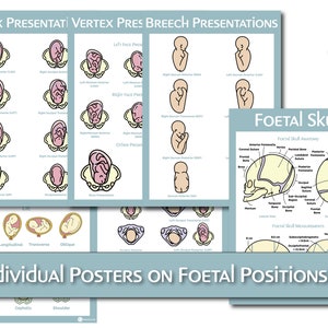 Foetal/fetal Position Study Bundle Educational Poster - Etsy