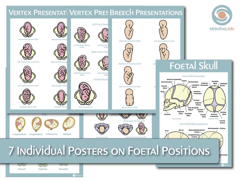 Foetal/fetal Position Study Bundle Educational Poster - Etsy