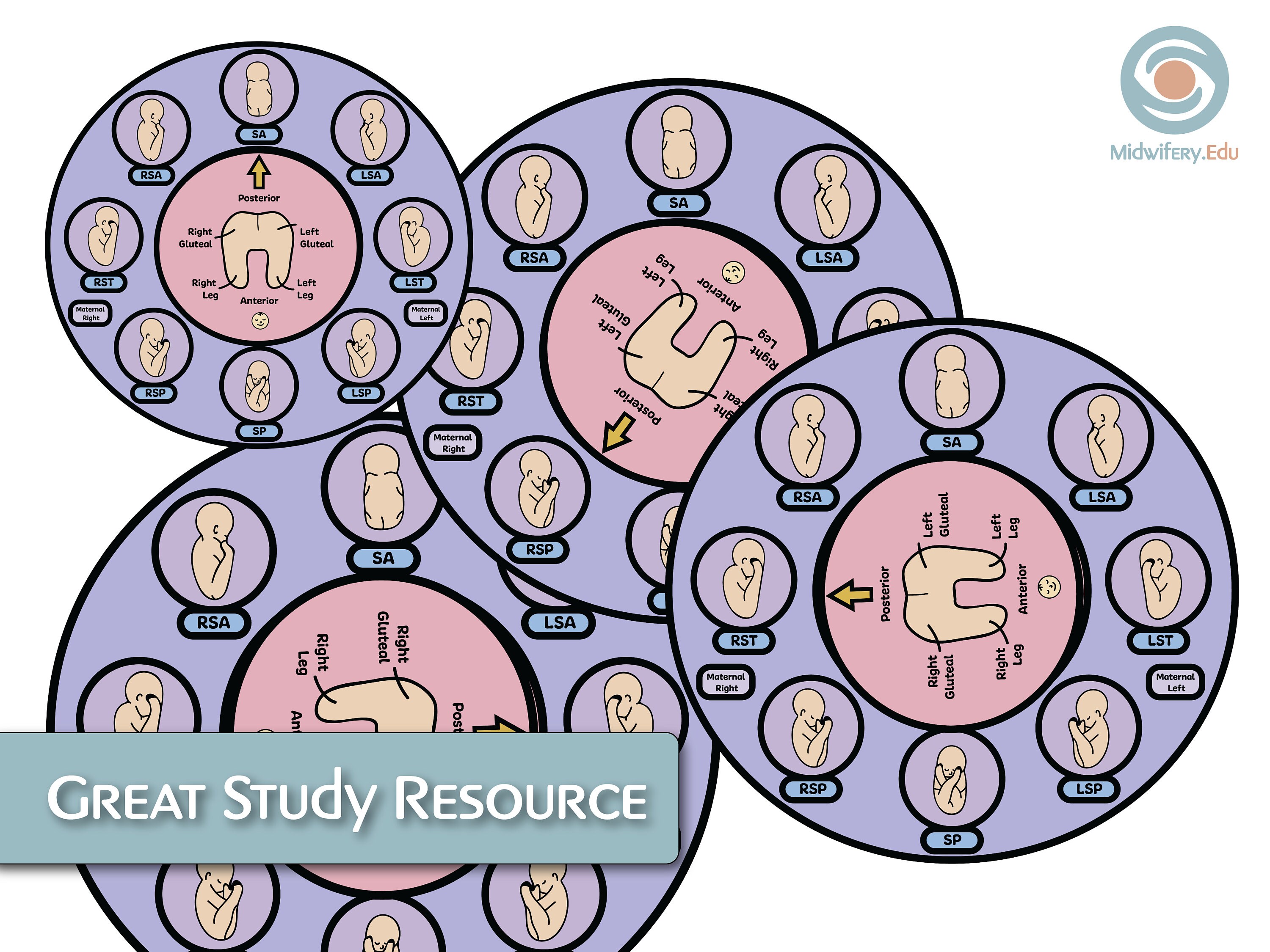 Breech Position Birth Wheel - Etsy