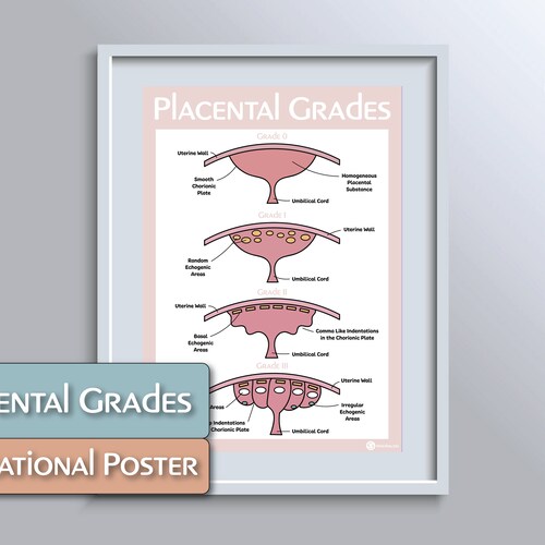 Placenta Educational Poster Study Bundle - Etsy