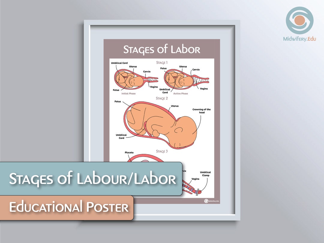 Stages of Labour/labor Educational Poster - Etsy