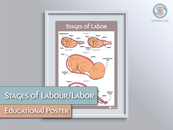 Stages of Labour/labor Educational Poster | Etsy UK