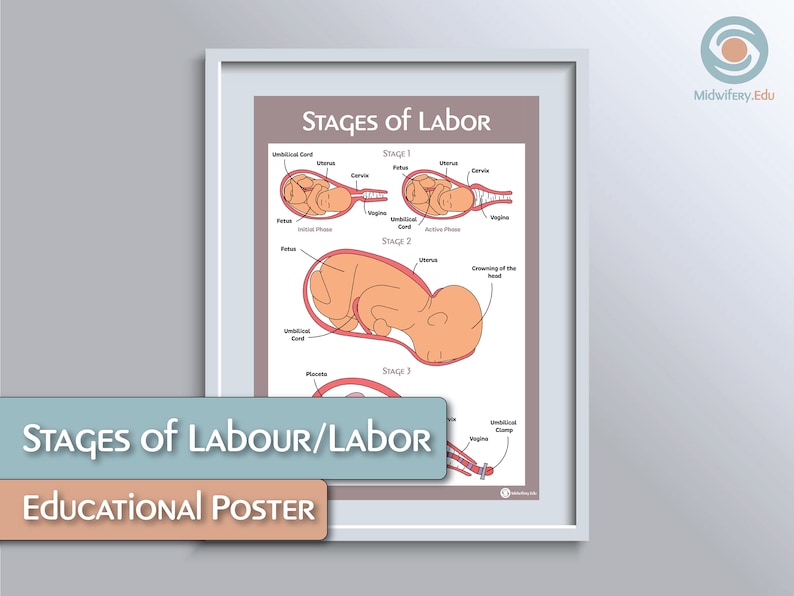 Stages of Labour/labor Educational Poster - Etsy