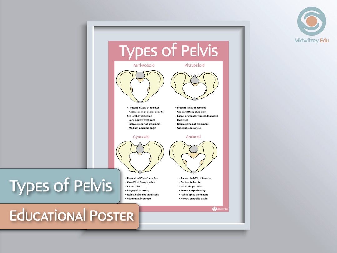 Types of Pelvis Educational Poster - Etsy New Zealand