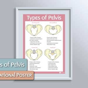 Types of Pelvis Educational Poster - Etsy