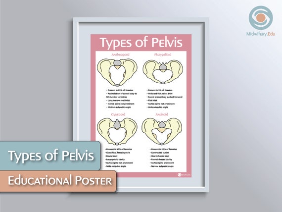 Types of Pelvis Educational Poster - Etsy Hong Kong