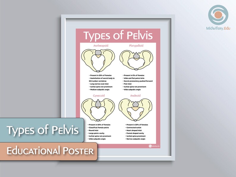 Types of Pelvis Educational Poster - Etsy