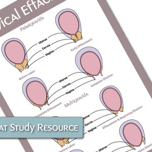 Cervical Effacement Educational Poster - Etsy