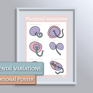 Placenta Variations Educational Poster - Etsy
