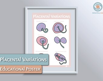Placenta Grading Educational Poster | Etsy