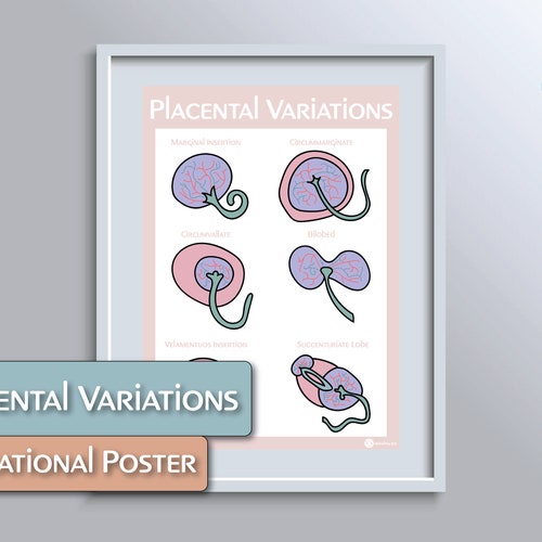Placenta Educational Poster Study Bundle - Etsy
