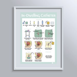In-dwelling Catheter Educational Poster - Etsy