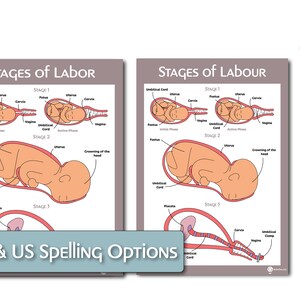Stages of Labour/labor Educational Poster - Etsy