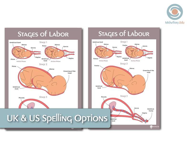 Stages of Labour/labor Educational Poster - Etsy