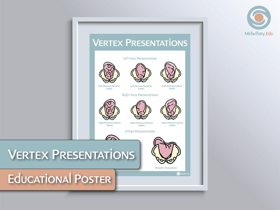 Vertex Presentation Educational Poster | Etsy