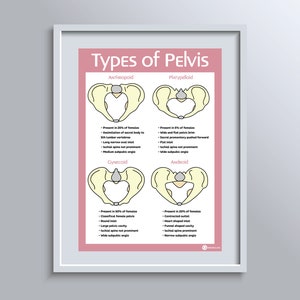 Types of Pelvis Educational Poster - Etsy