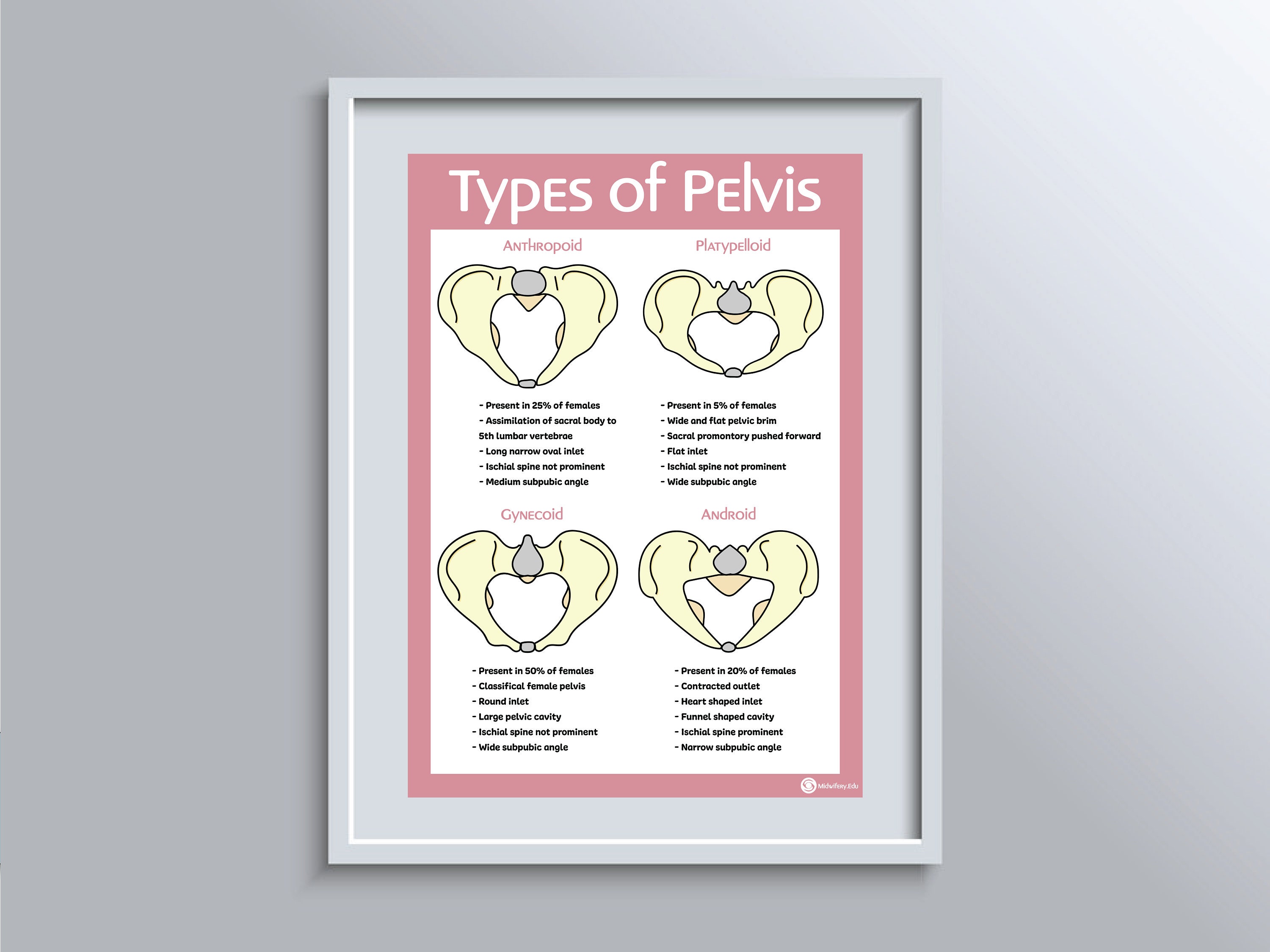 Types of Pelvis Educational Poster - Etsy