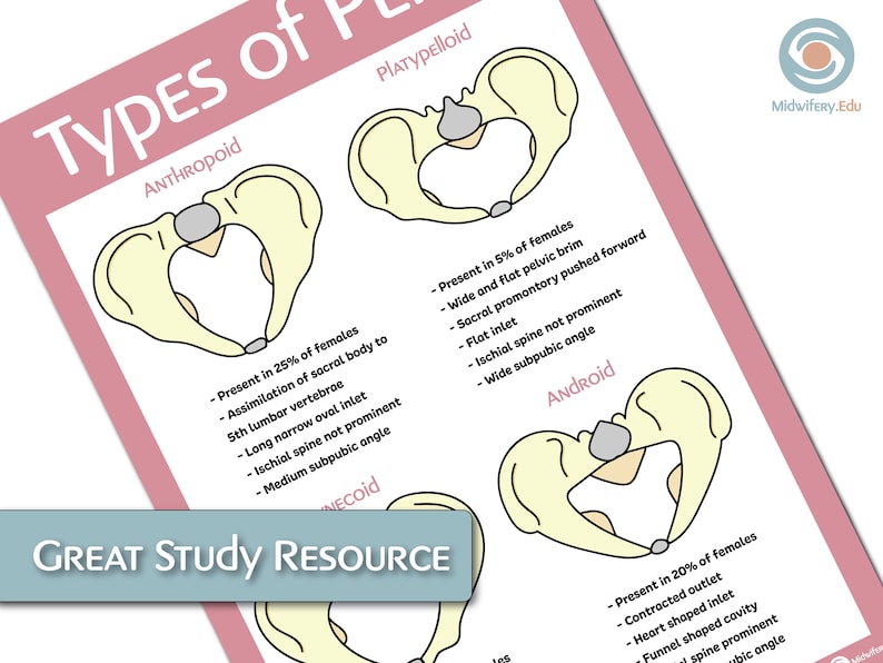 Types of Pelvis Educational Poster - Etsy