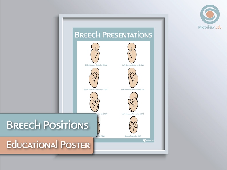 Breech Presentations Educational Poster - Etsy