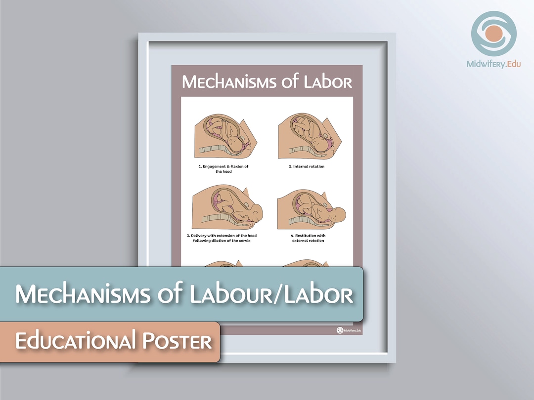 Labour/labor Mechanisms of Birth Educational Poster - Etsy