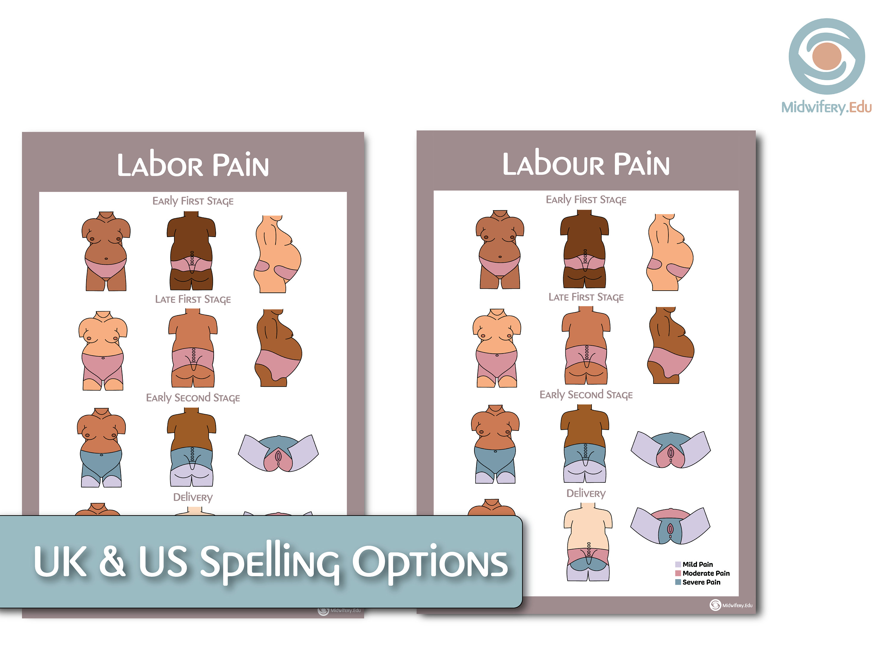 Labour/labor Pain Educational Poster - Etsy UK