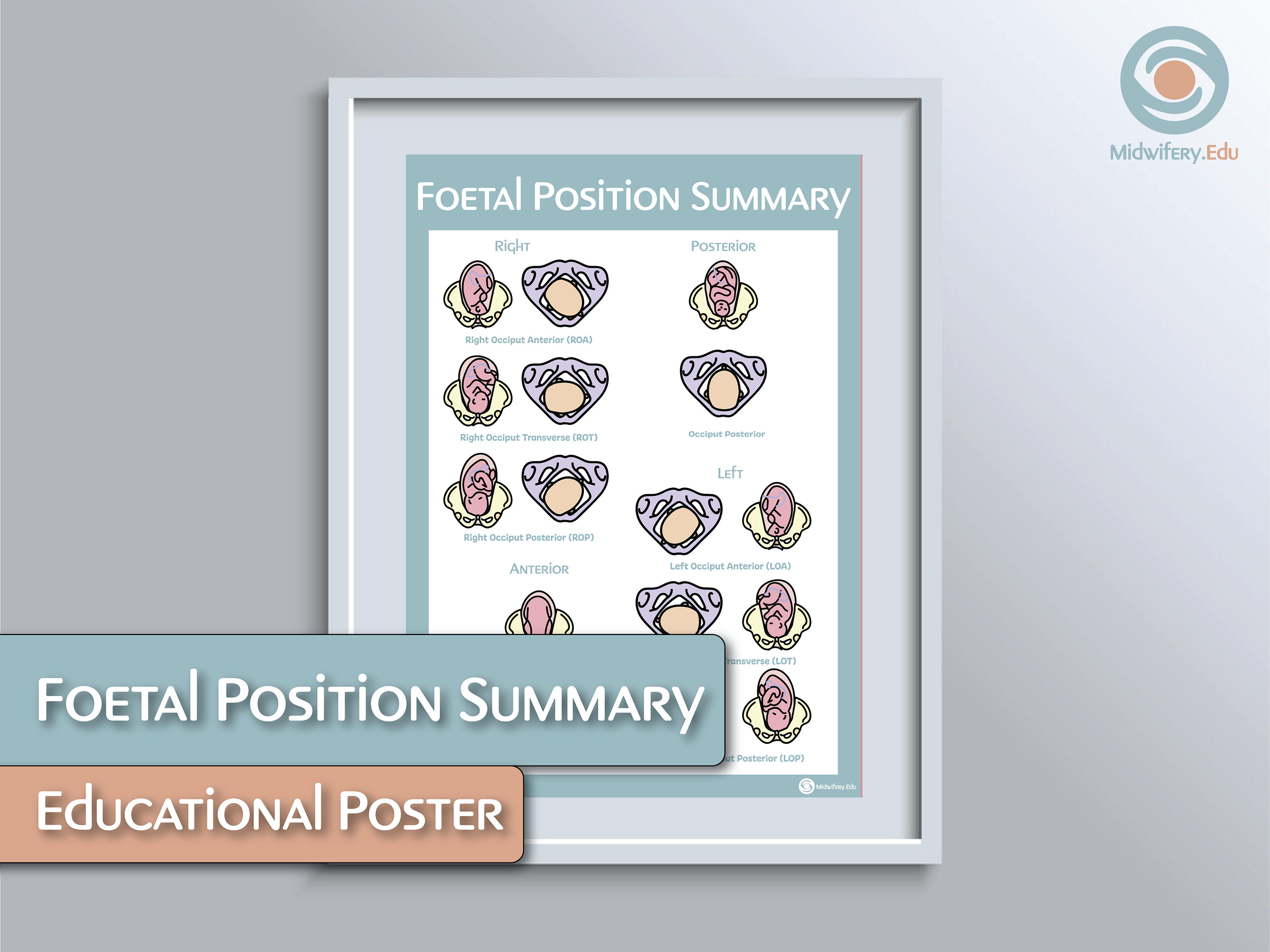 Foetal/fetal Position Summary Educational Poster - Etsy