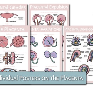 Placenta Educational Poster Study Bundle - Etsy