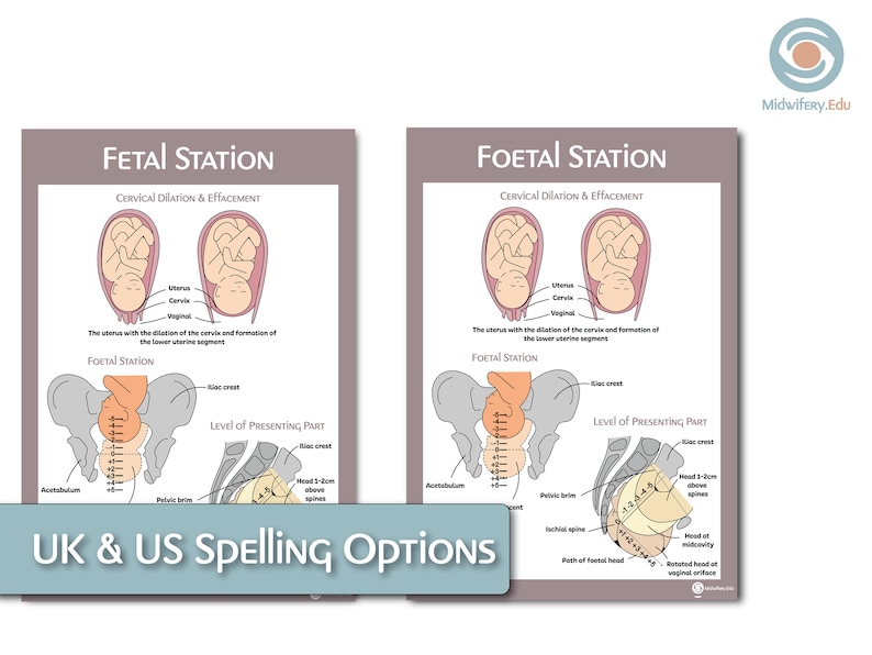 Foetal/fetal Station Educational Poster - Etsy