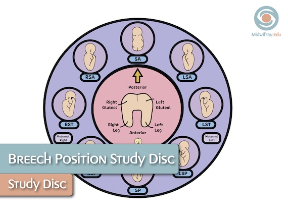 Breech Position Birth Wheel - Etsy