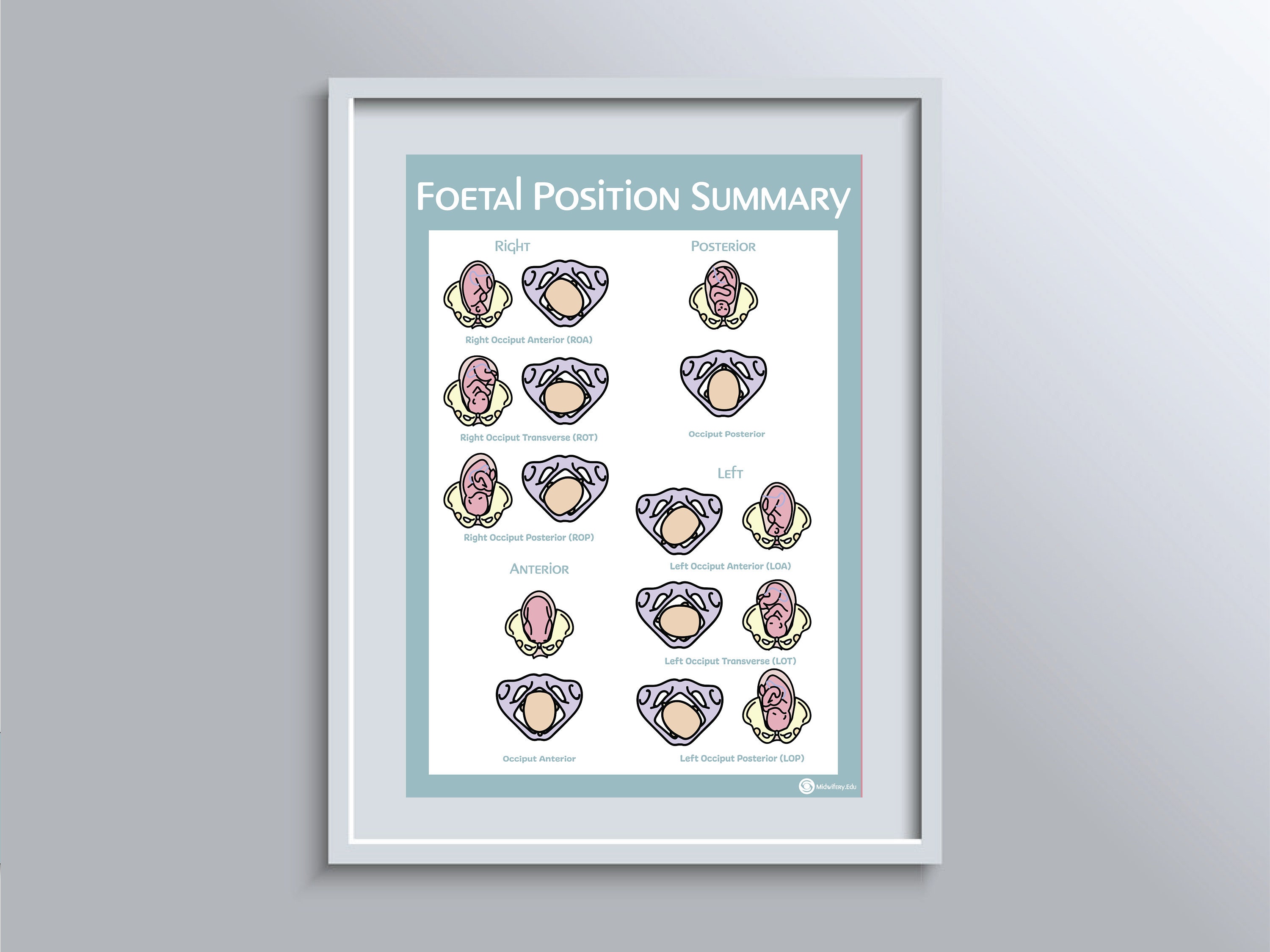 Foetal/fetal Position Summary Educational Poster - Etsy