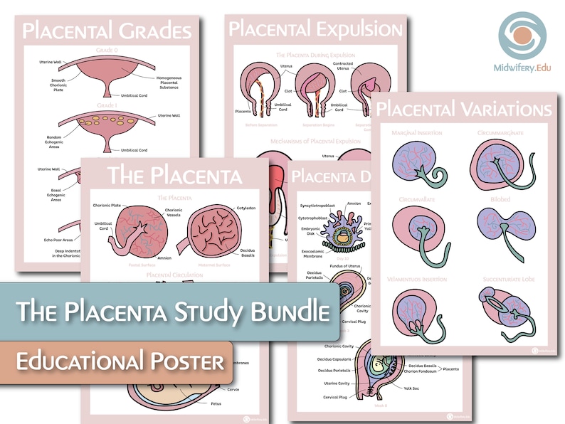 Placenta Educational Poster Study Bundle | Etsy