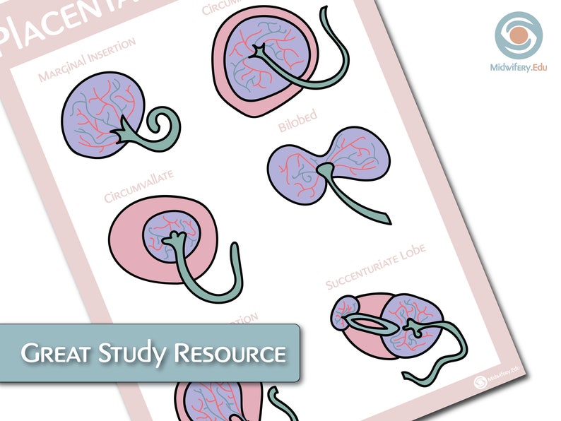 Placenta Educational Poster Study Bundle | Etsy