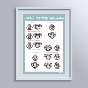 Foetal/fetal Position Study Bundle Educational Poster - Etsy