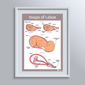 Stages of Labour/labor Educational Poster - Etsy