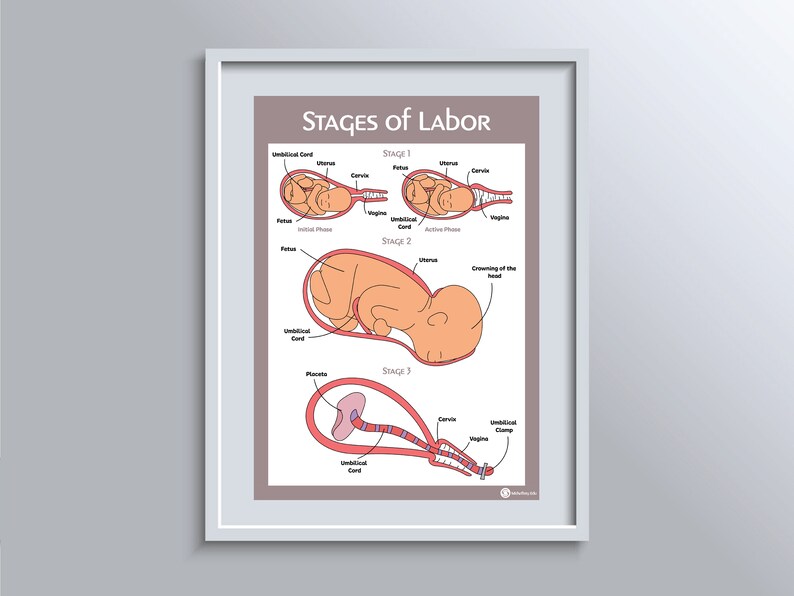 Stages of Labour/labor Educational Poster - Etsy
