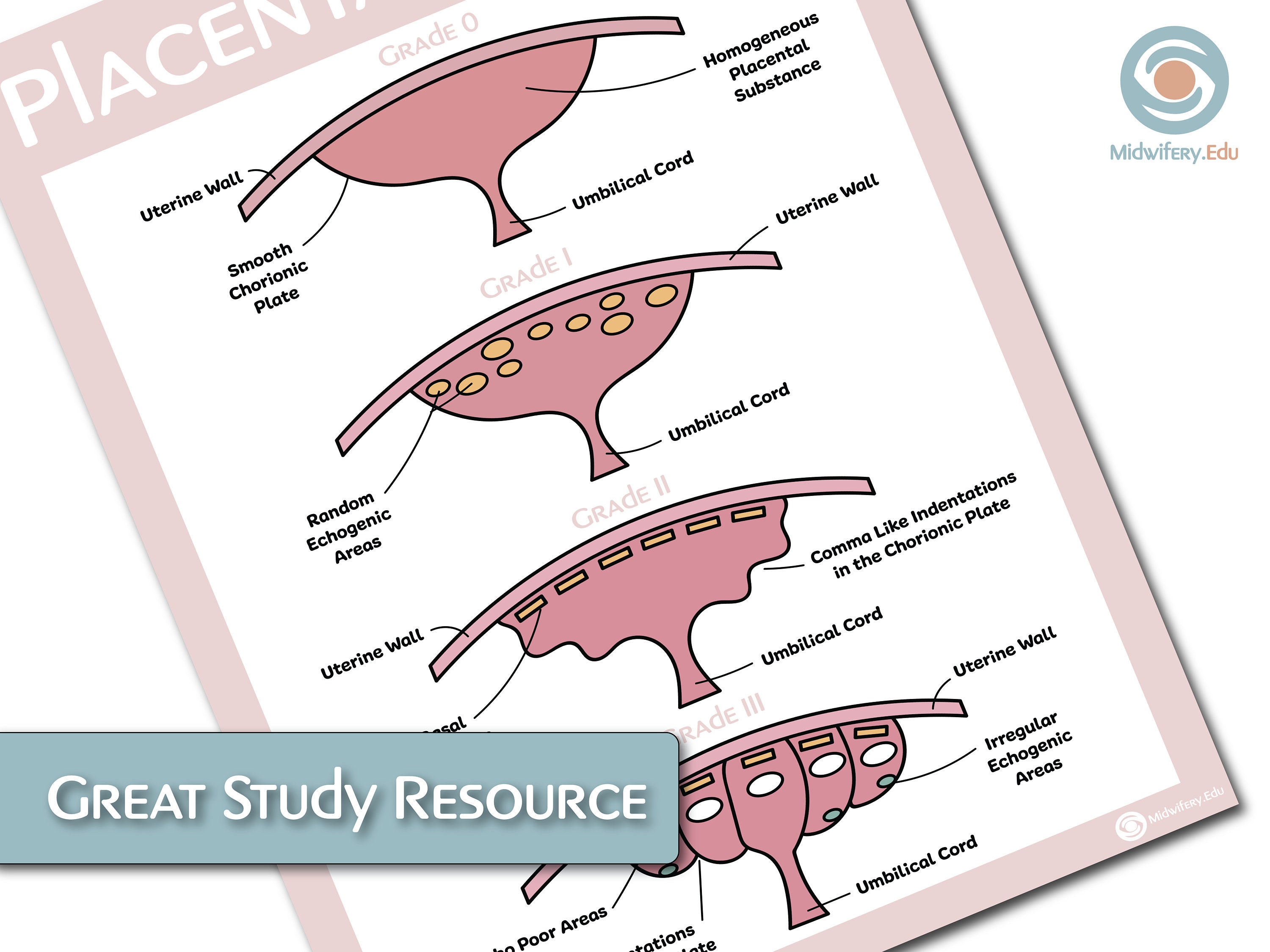 Placenta Educational Poster Study Bundle | Etsy