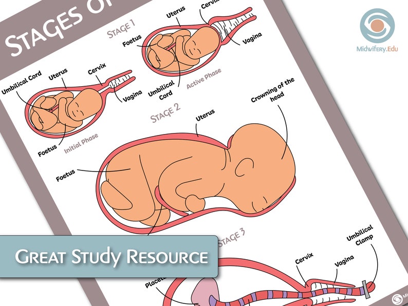 Labour/labor Education Poster Bundle - Etsy