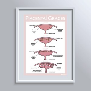 Placenta Educational Poster Study Bundle - Etsy