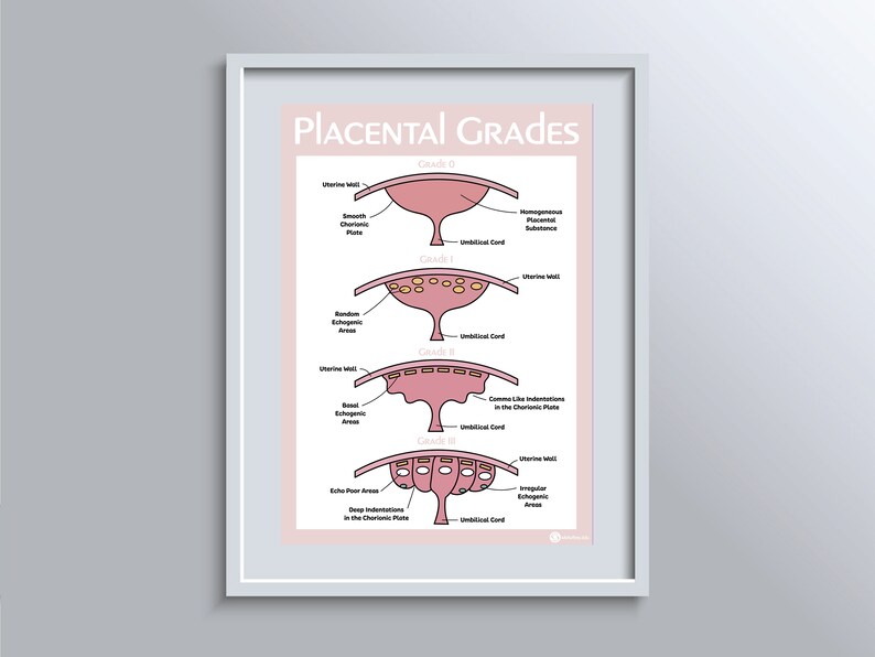 Placenta Educational Poster Study Bundle | Etsy