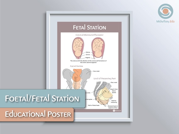 Foetal/fetal Station Educational Poster | Etsy