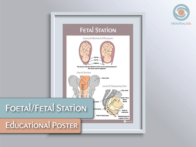 Foetalfetal Station Educational Poster Etsy