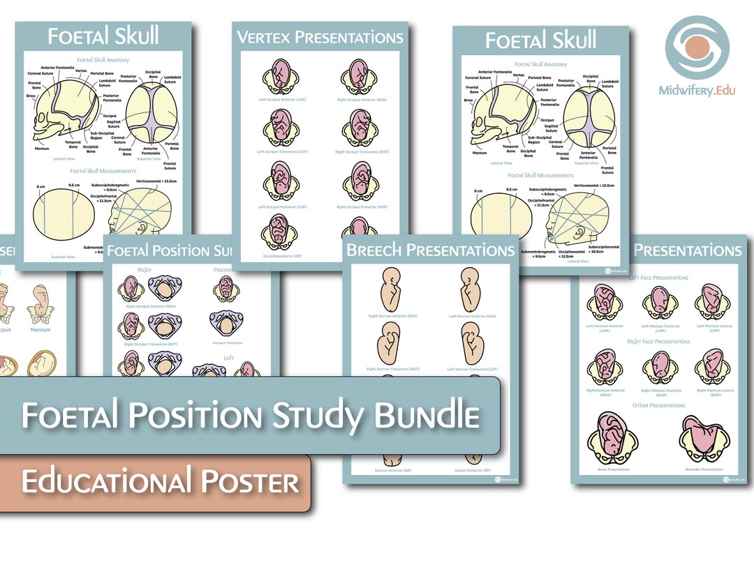 Foetal/fetal Position Study Bundle Educational Poster - Etsy