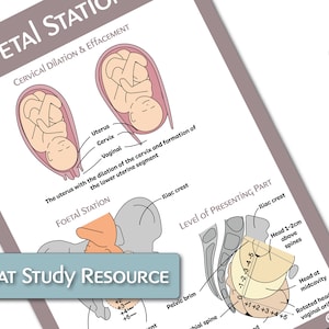 Foetal/fetal Station Educational Poster - Etsy
