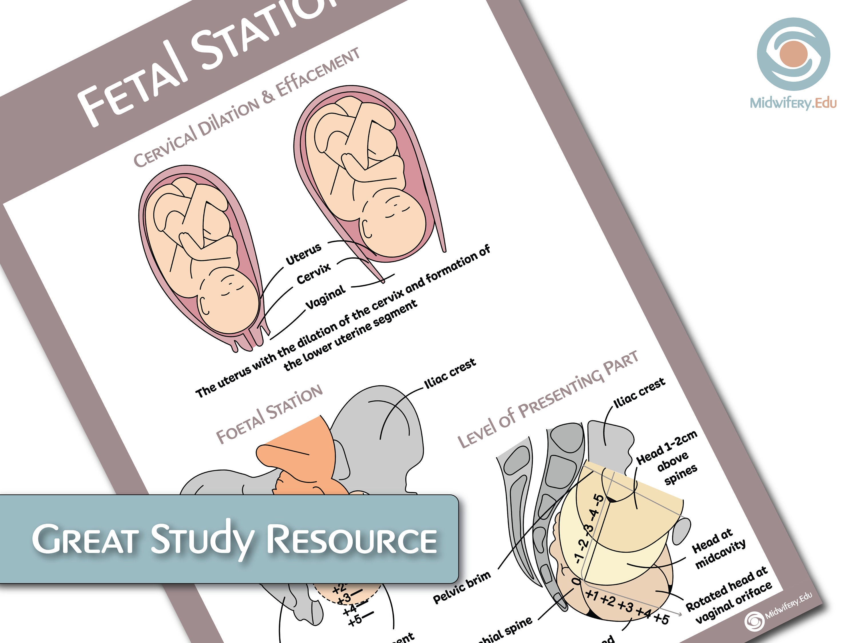 Foetal/fetal Station Educational Poster - Etsy